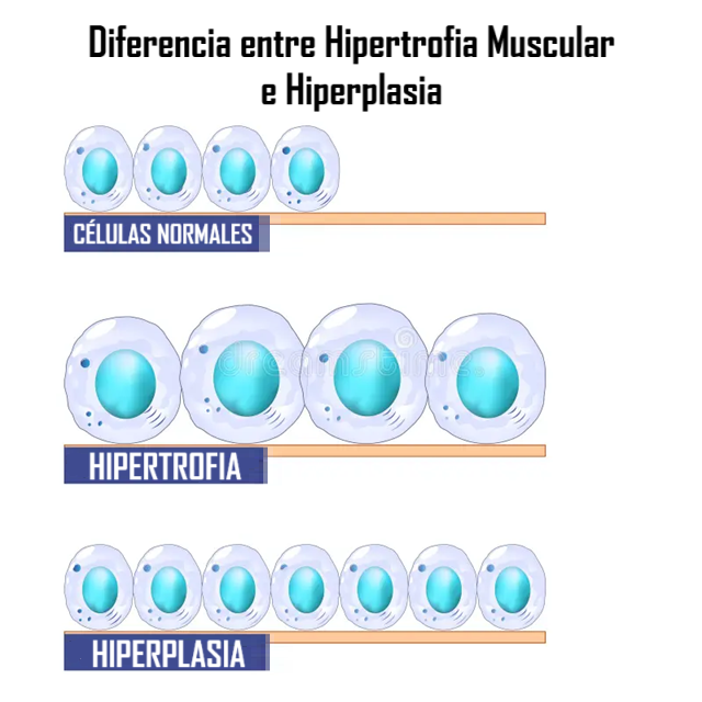 Diferencia entre Hipertrofia Muscular e Hiperplasia